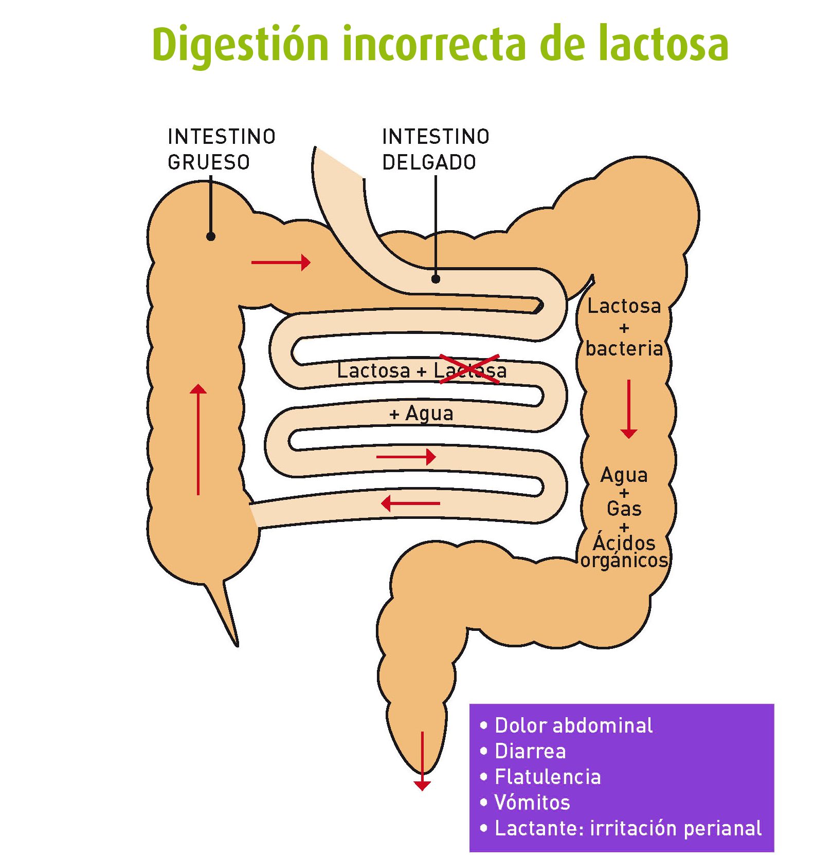 Sìntomas De Intolerancia A La Lactosa ⊛ ¡prevención Y Tratamiento 2020